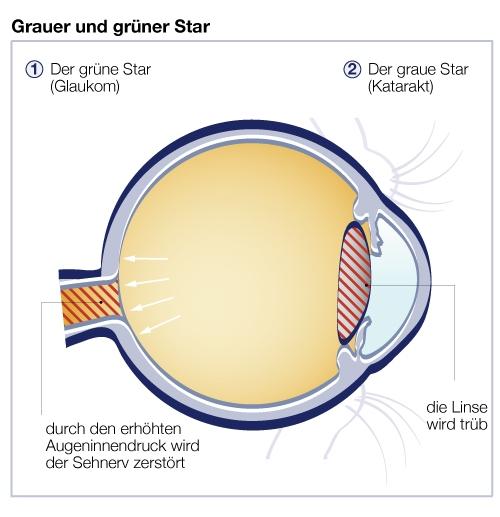 Faszinierend Was Ist Gruner Star Fotosnull